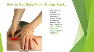 The patient's guide to trigger points | PPTX