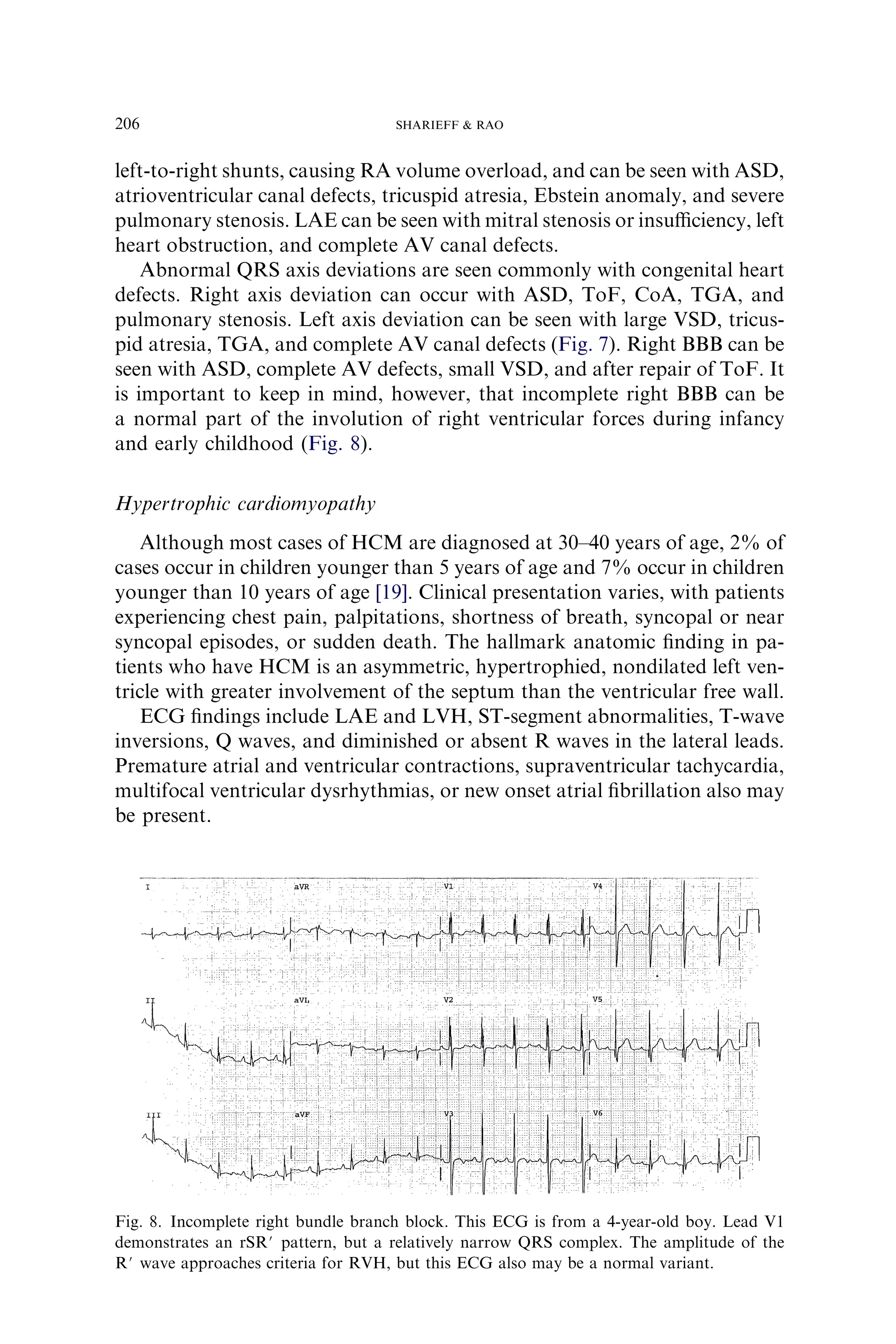The pediatric ecg | PDF