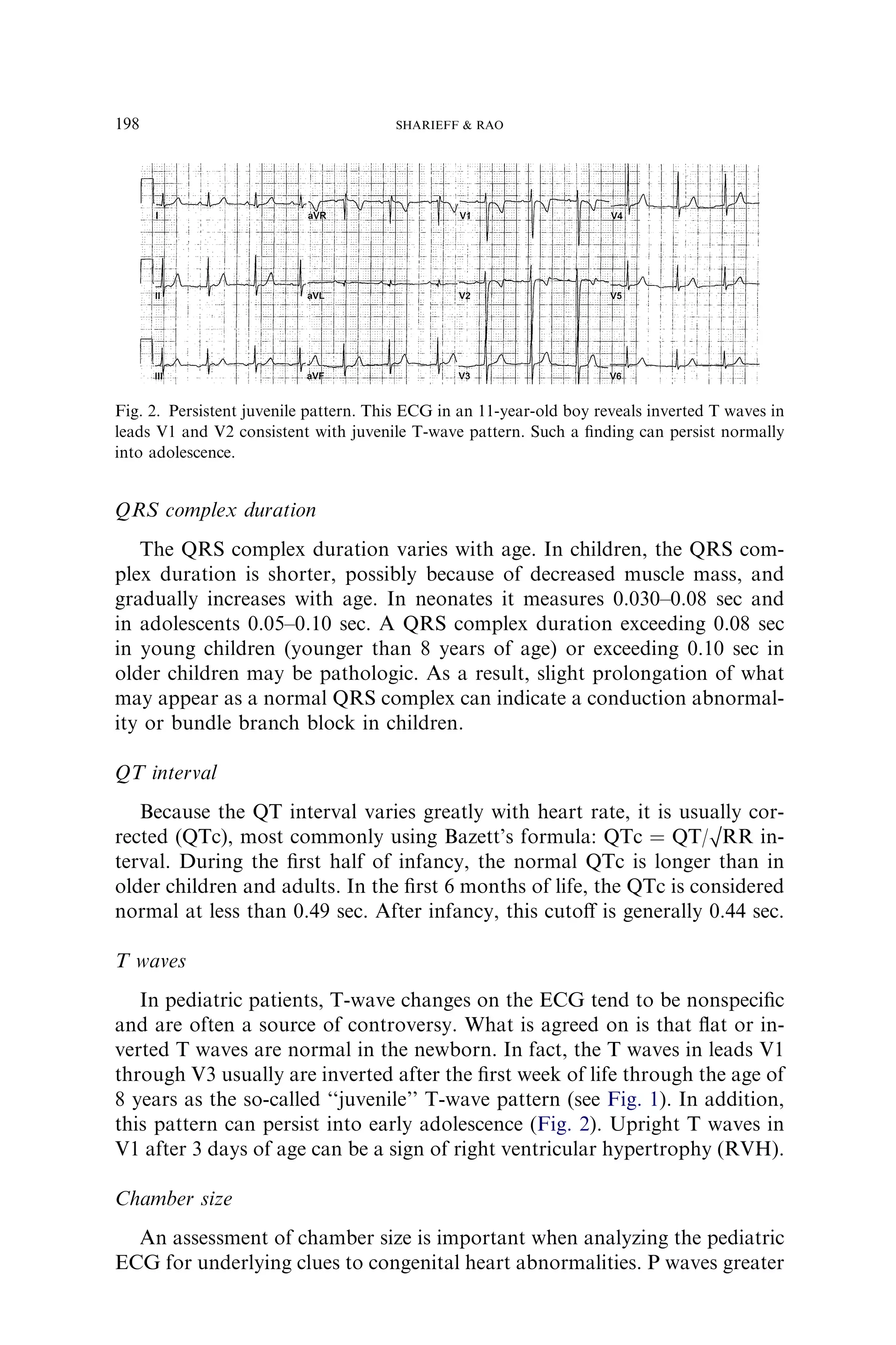 The pediatric ecg | PDF