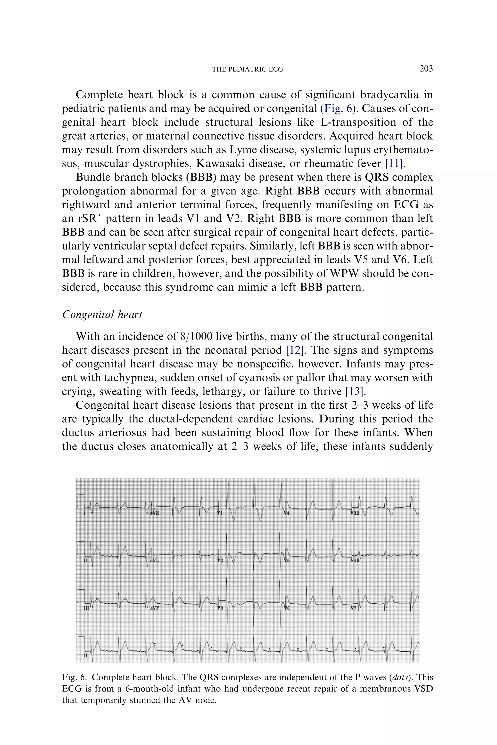 The pediatric ecg | PDF