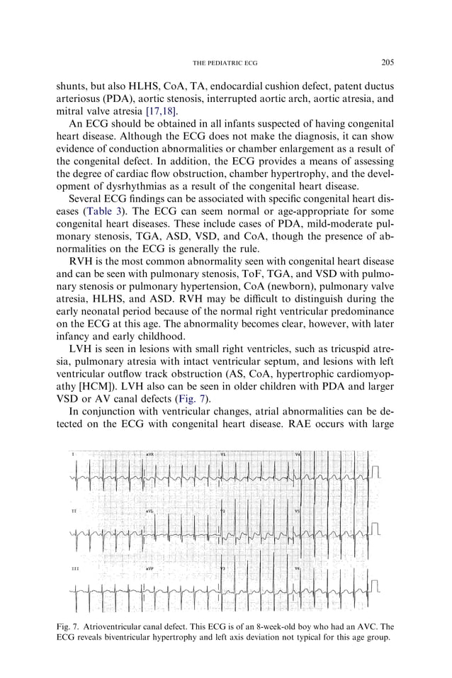 The pediatric ecg | PDF
