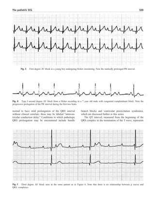 The pediatric electrocardiogram 1 | PDF