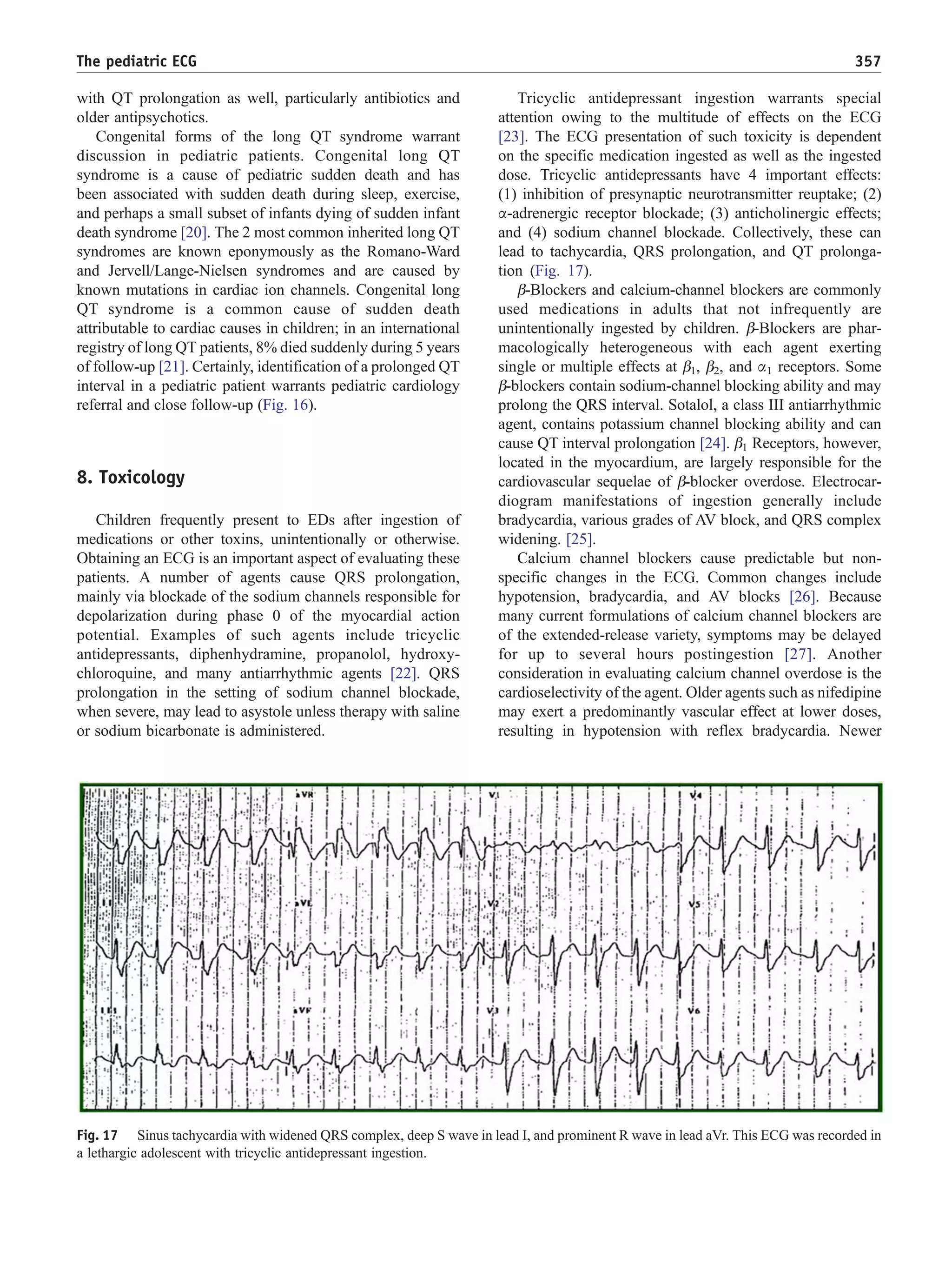 The pediatric electrocardiogram 2 | PDF