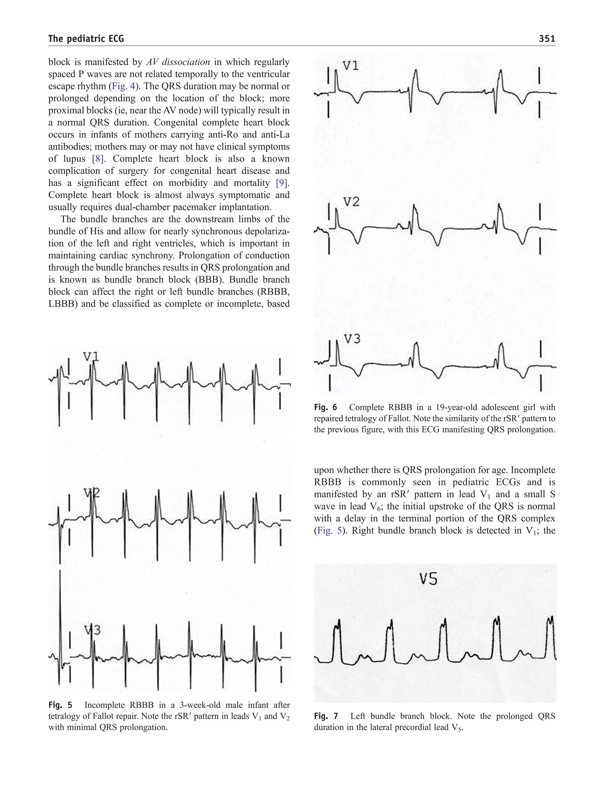 The pediatric electrocardiogram 2 | PDF