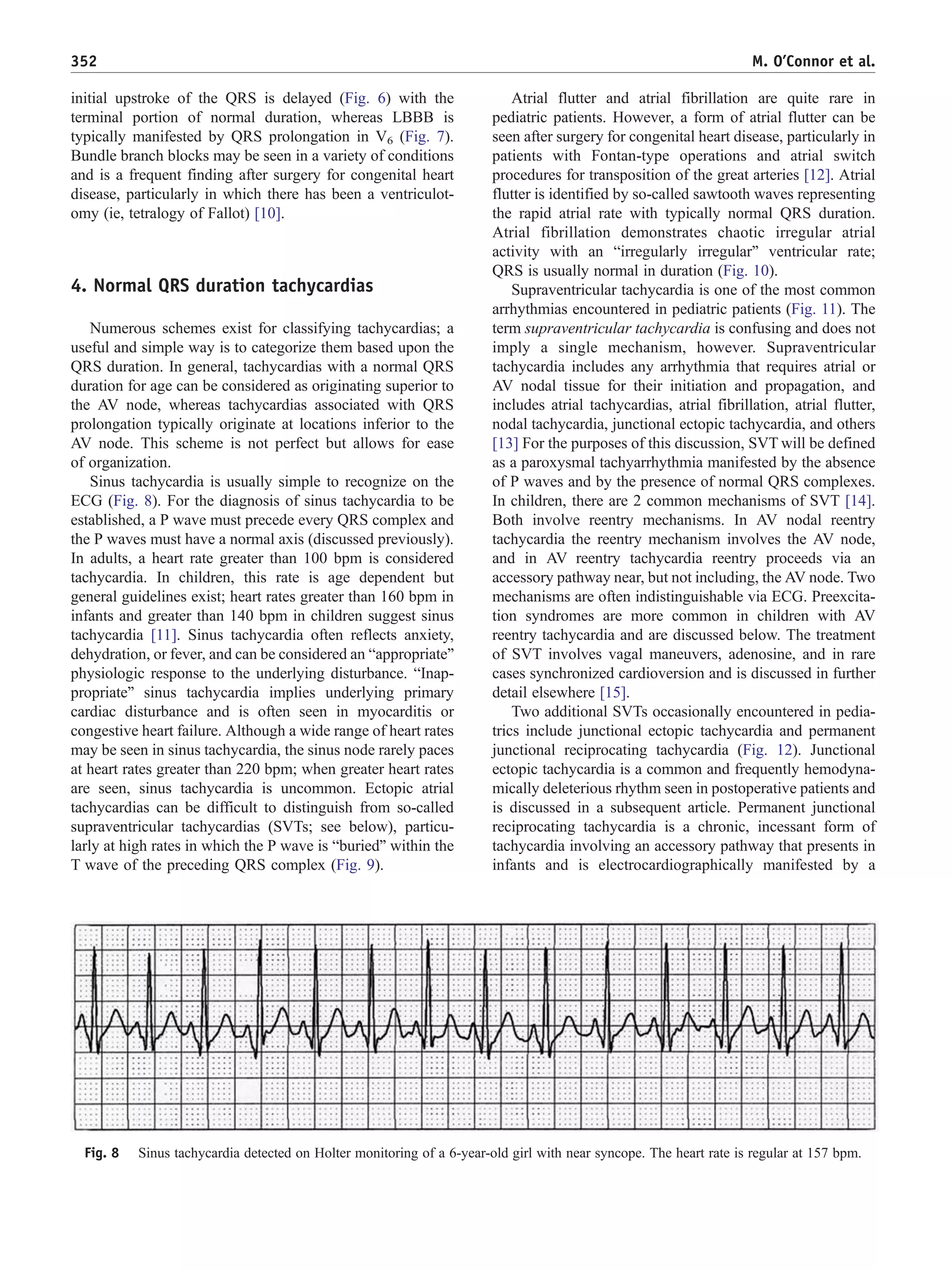 The pediatric electrocardiogram 2 | PDF