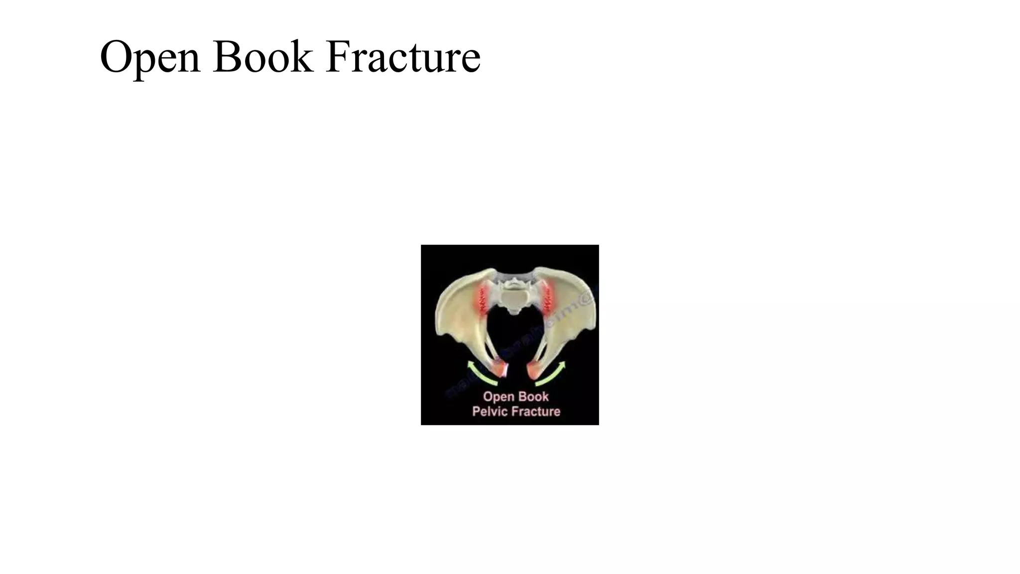 The Pelvis.pptx