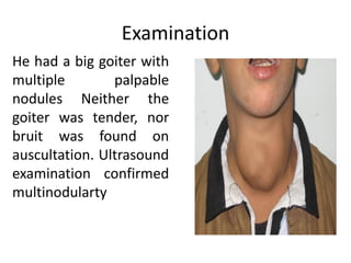 The pendred syndrome | PPT