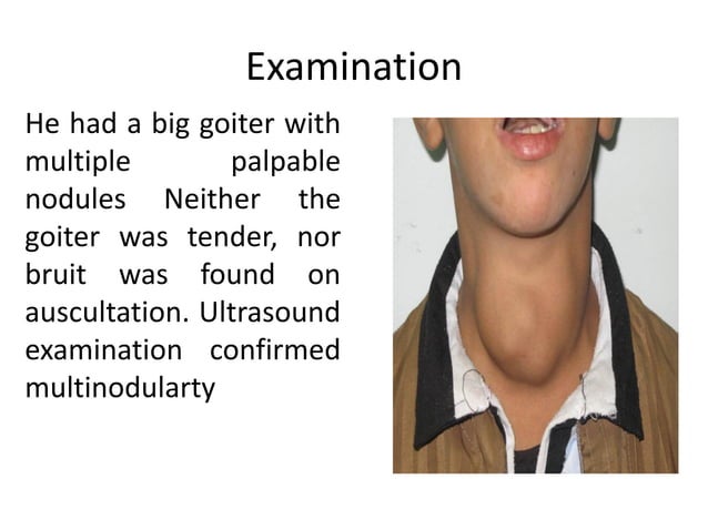 The pendred syndrome | PPT