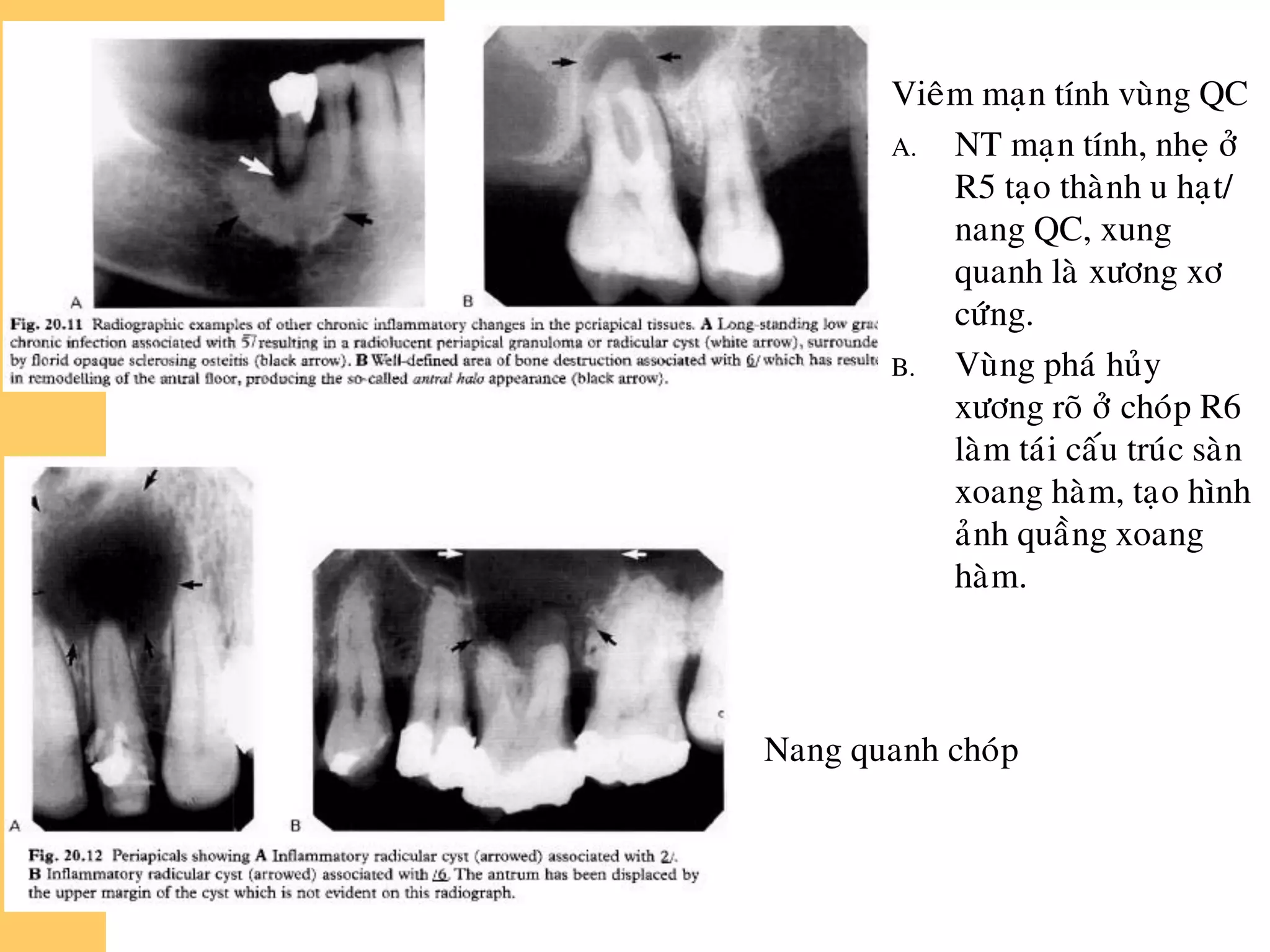 The periapical tissues | PDF