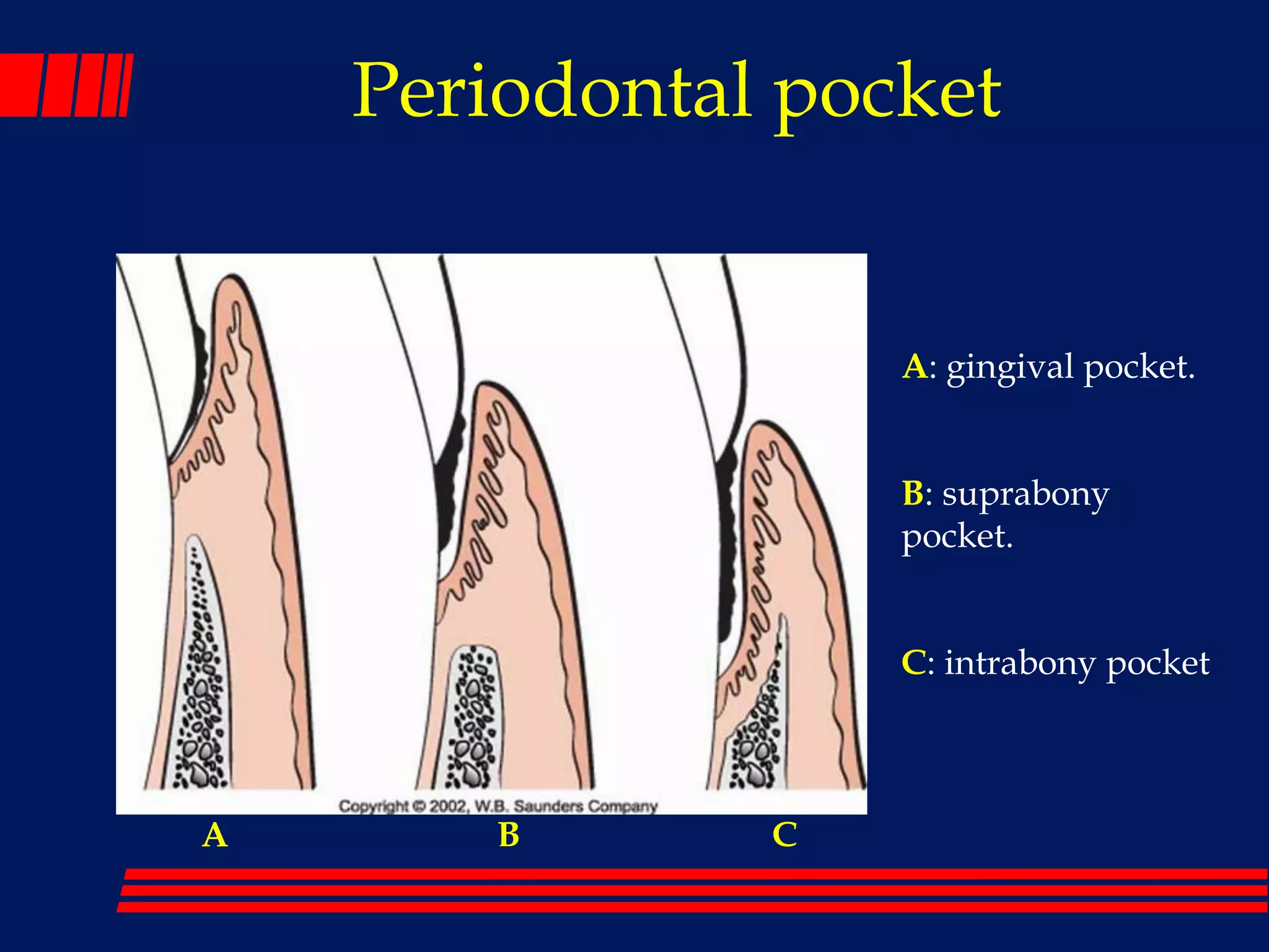 The periodontal examination_and_diagnosis_lec 1 | PDF