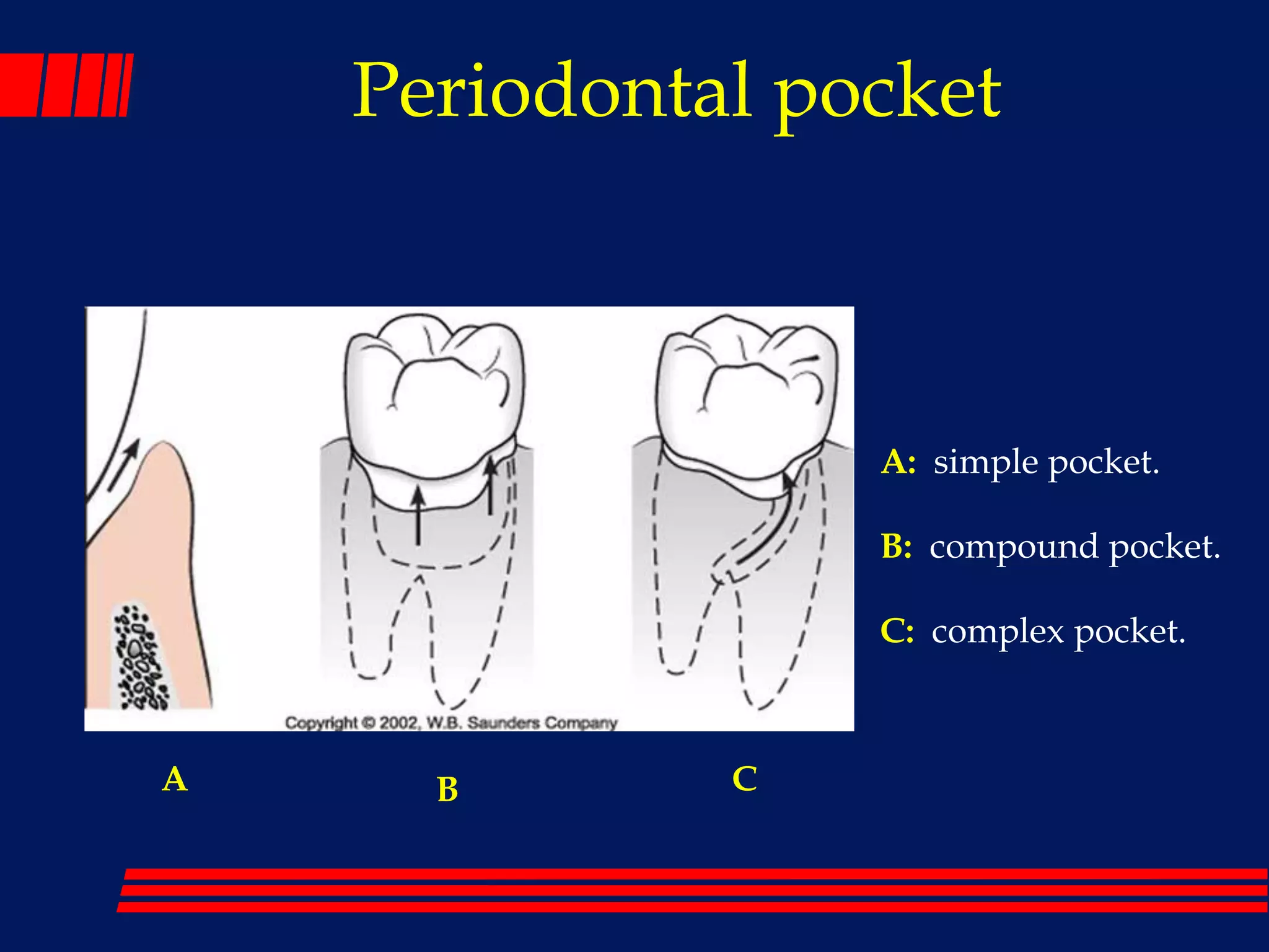 The periodontal examination_and_diagnosis_lec 1 | PDF