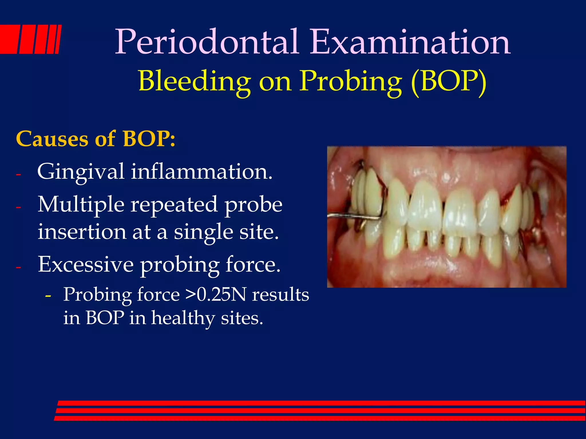 The periodontal examination_and_diagnosis_lec 1 | PDF