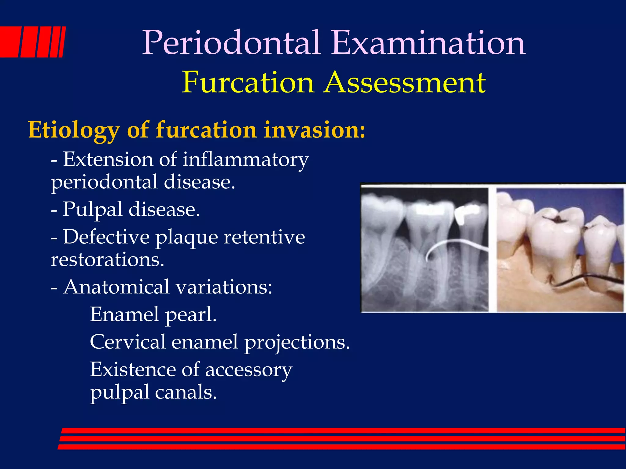 The periodontal examination_and_diagnosis_lec 1 | PDF