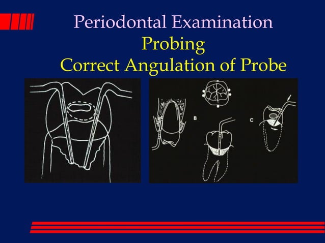 The periodontal examination_and_diagnosis_lec 1 | PDF
