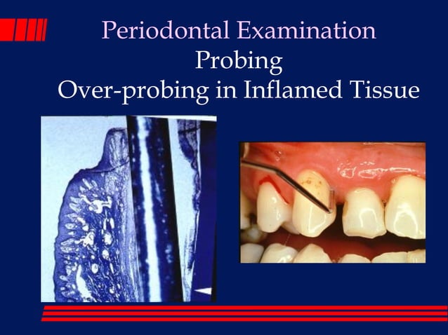 The periodontal examination_and_diagnosis_lec 1 | PDF