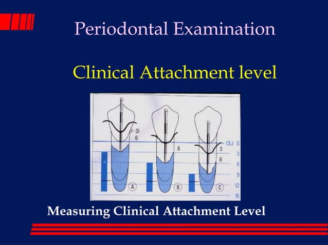 The periodontal examination_and_diagnosis_lec 1 | PDF