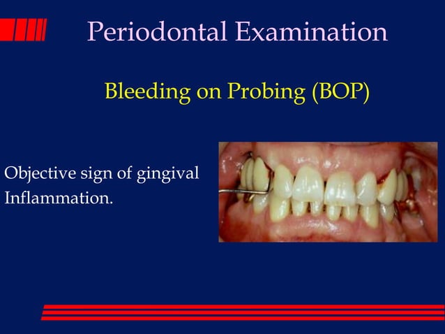 The periodontal examination_and_diagnosis_lec 1 | PDF
