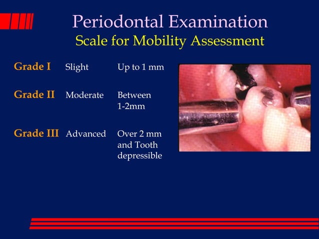 The periodontal examination_and_diagnosis_lec 1 | PDF