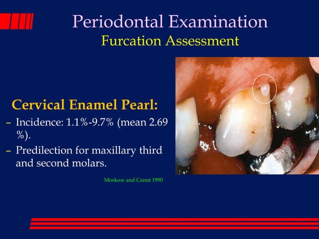 The periodontal examination_and_diagnosis_lec 1 | PDF