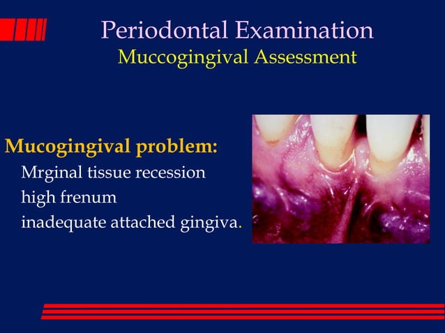 The periodontal examination_and_diagnosis_lec 1 | PDF