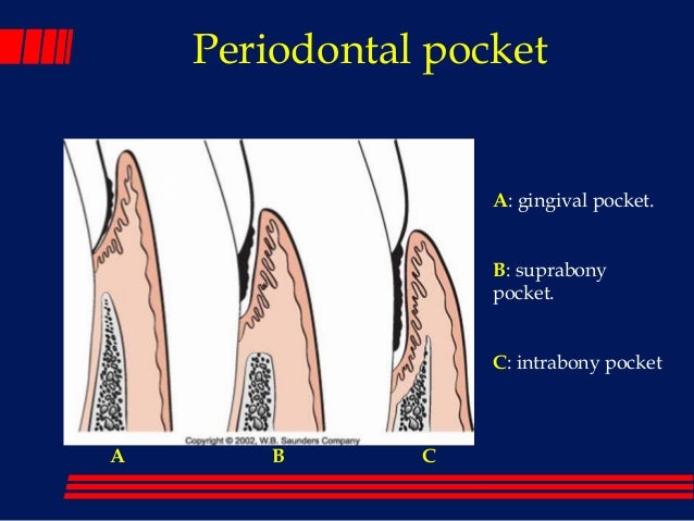 The periodontal examination_and_diagnosis_lec 1