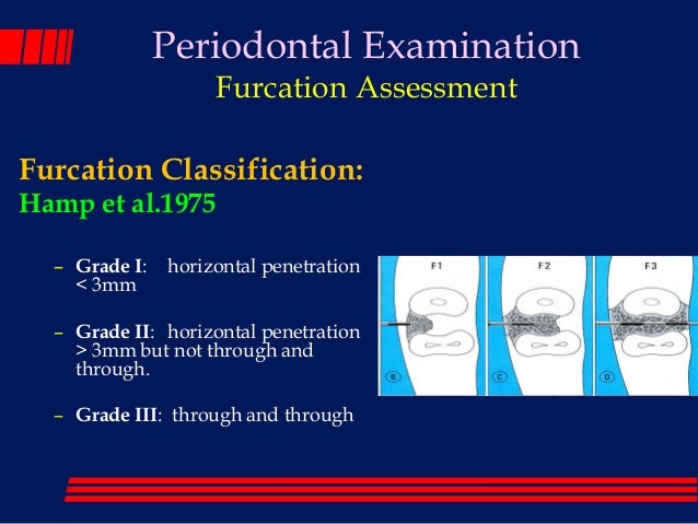 The Periodontal Examination And Diagnosis Lec 1