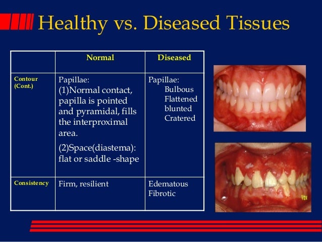 The periodontal examination_and_diagnosis_lec 1