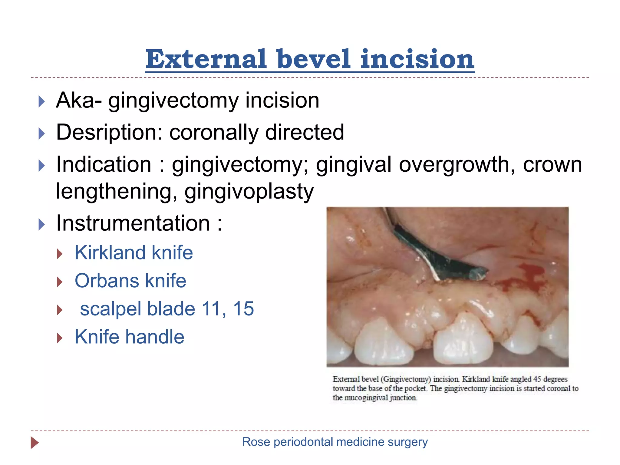 The periodontal flap | PPTX