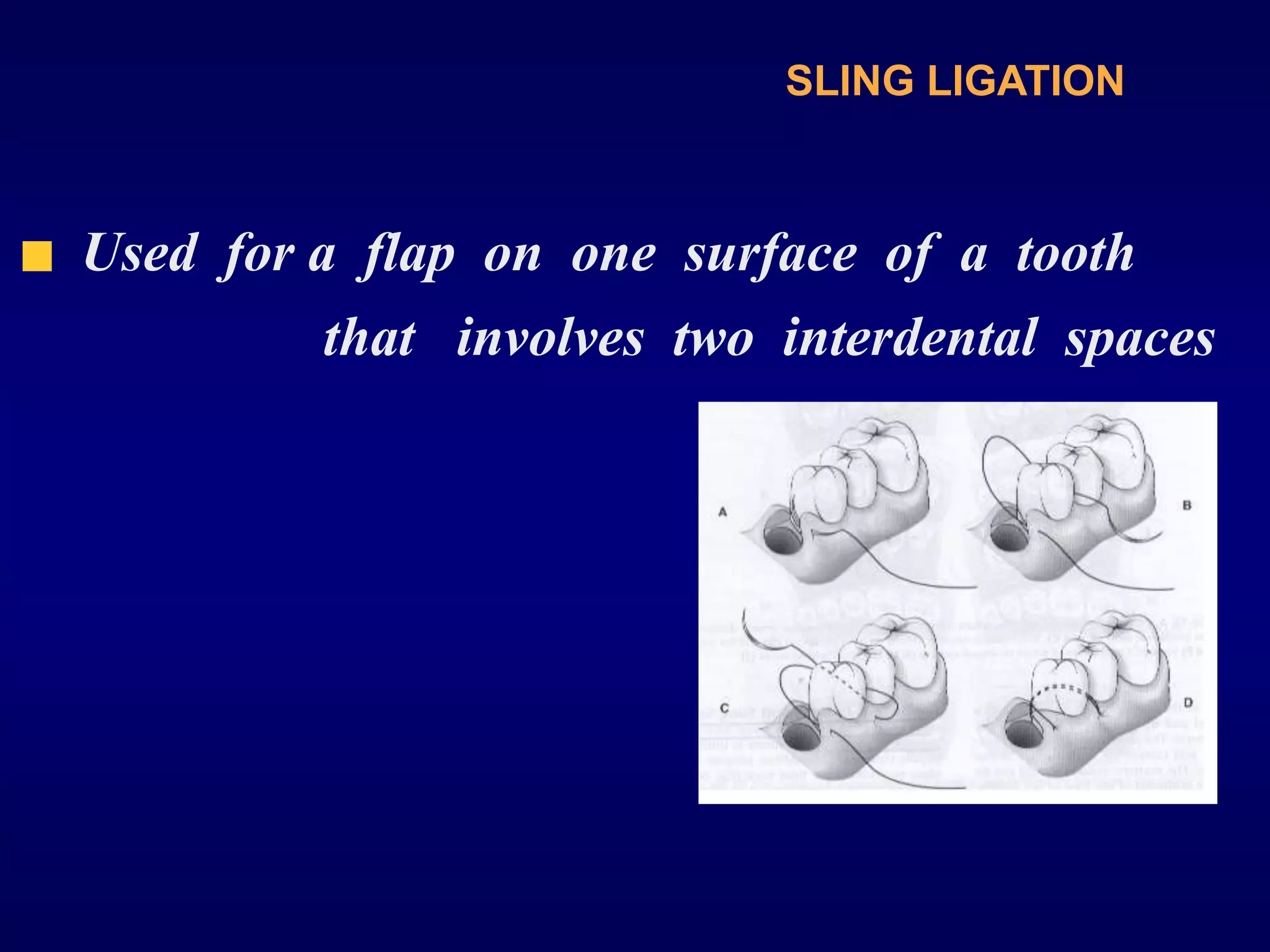 THE PERIODONTAL FLAP.ppt