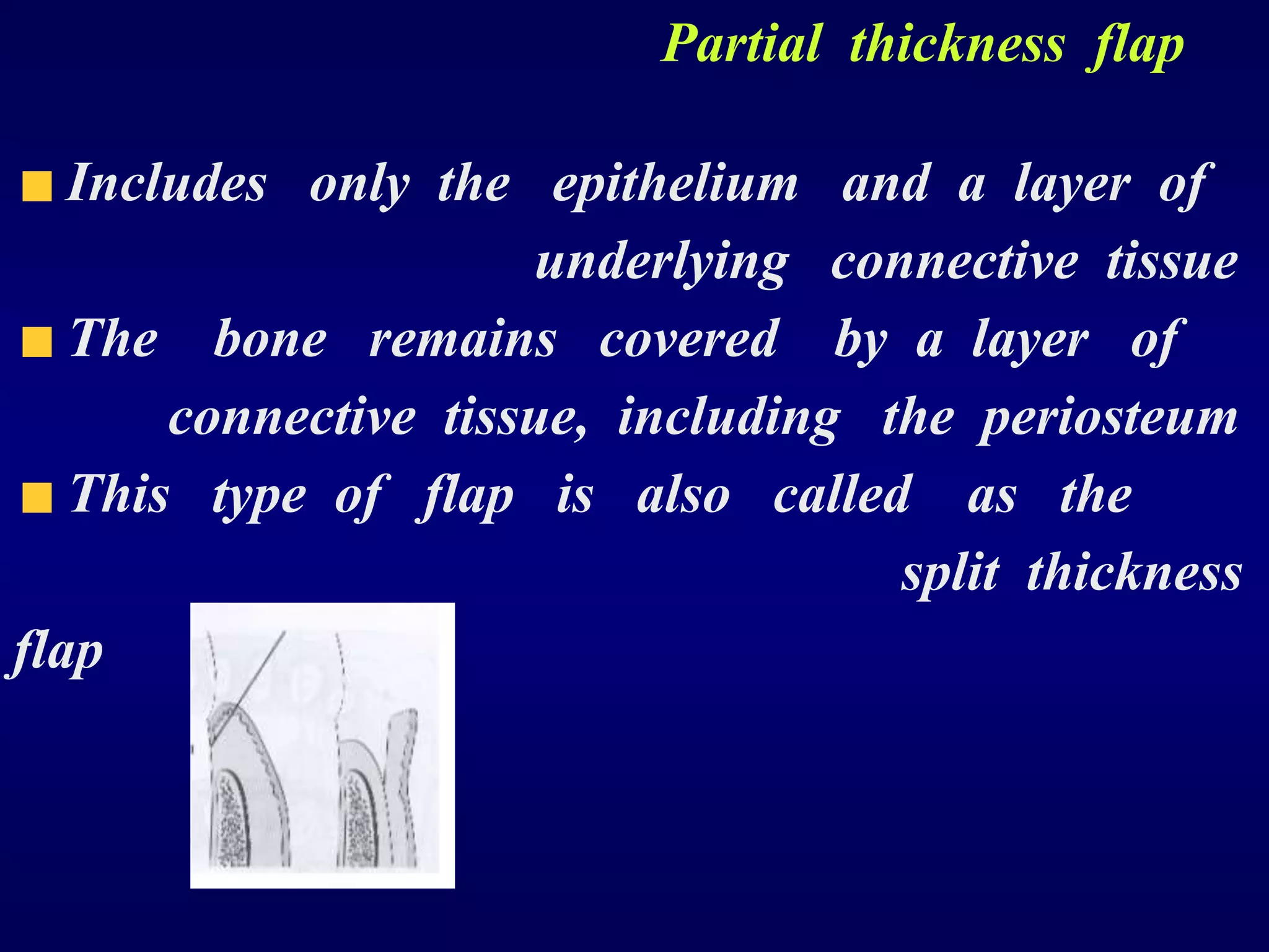 THE PERIODONTAL FLAP.ppt