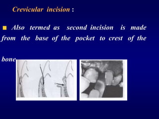 THE PERIODONTAL FLAP.ppt