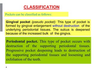 The periodontal pocket - lec 2 | PPT
