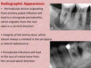 The periodontic endodontic continuum. | PPTX