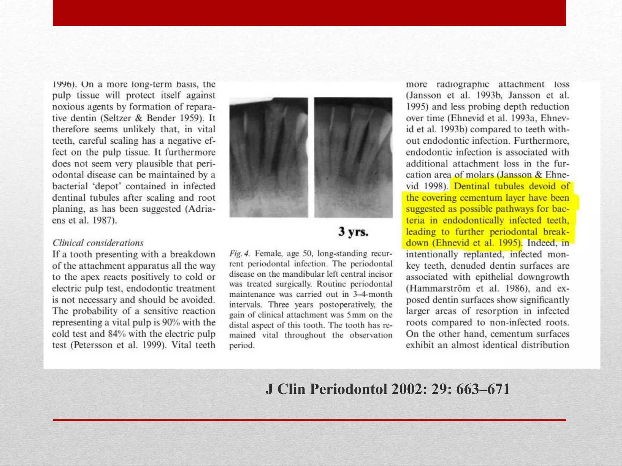 Perio Endo Inter-Relationship | PPTX