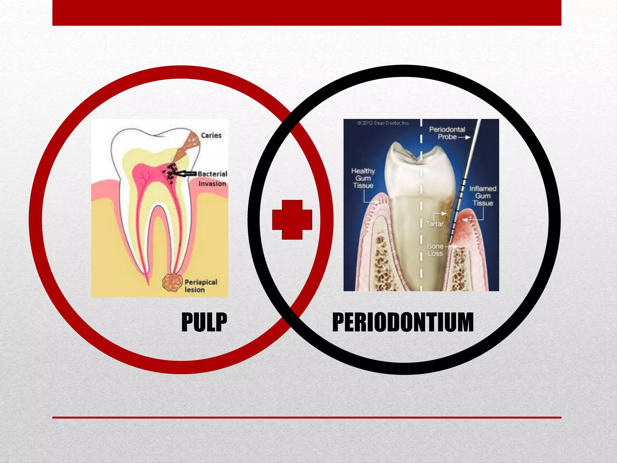 Perio Endo Inter-Relationship | PPTX