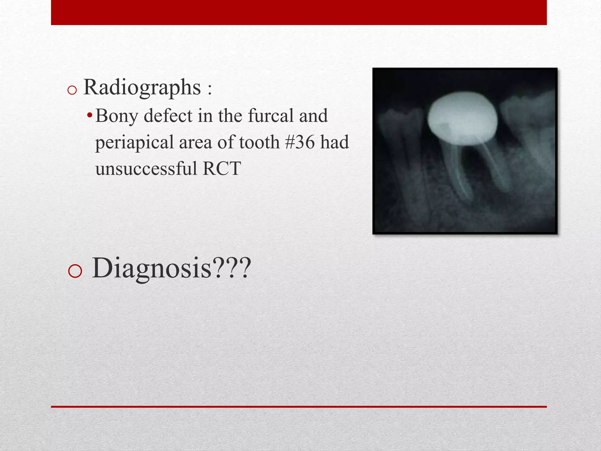 Perio Endo Inter-Relationship | PPTX