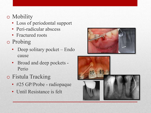 Perio Endo Inter-Relationship | PPTX