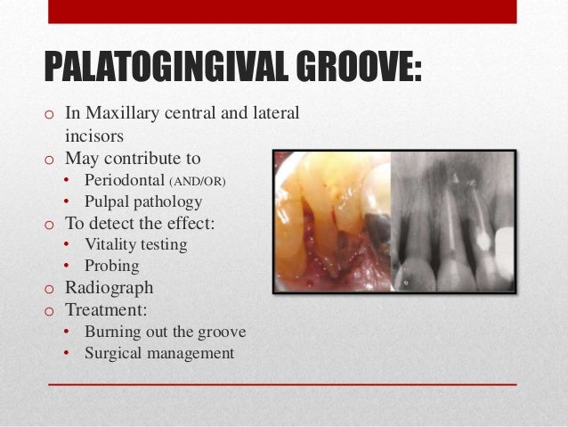 Perio Endo Inter-Relationship