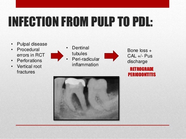 Perio Endo Inter-Relationship