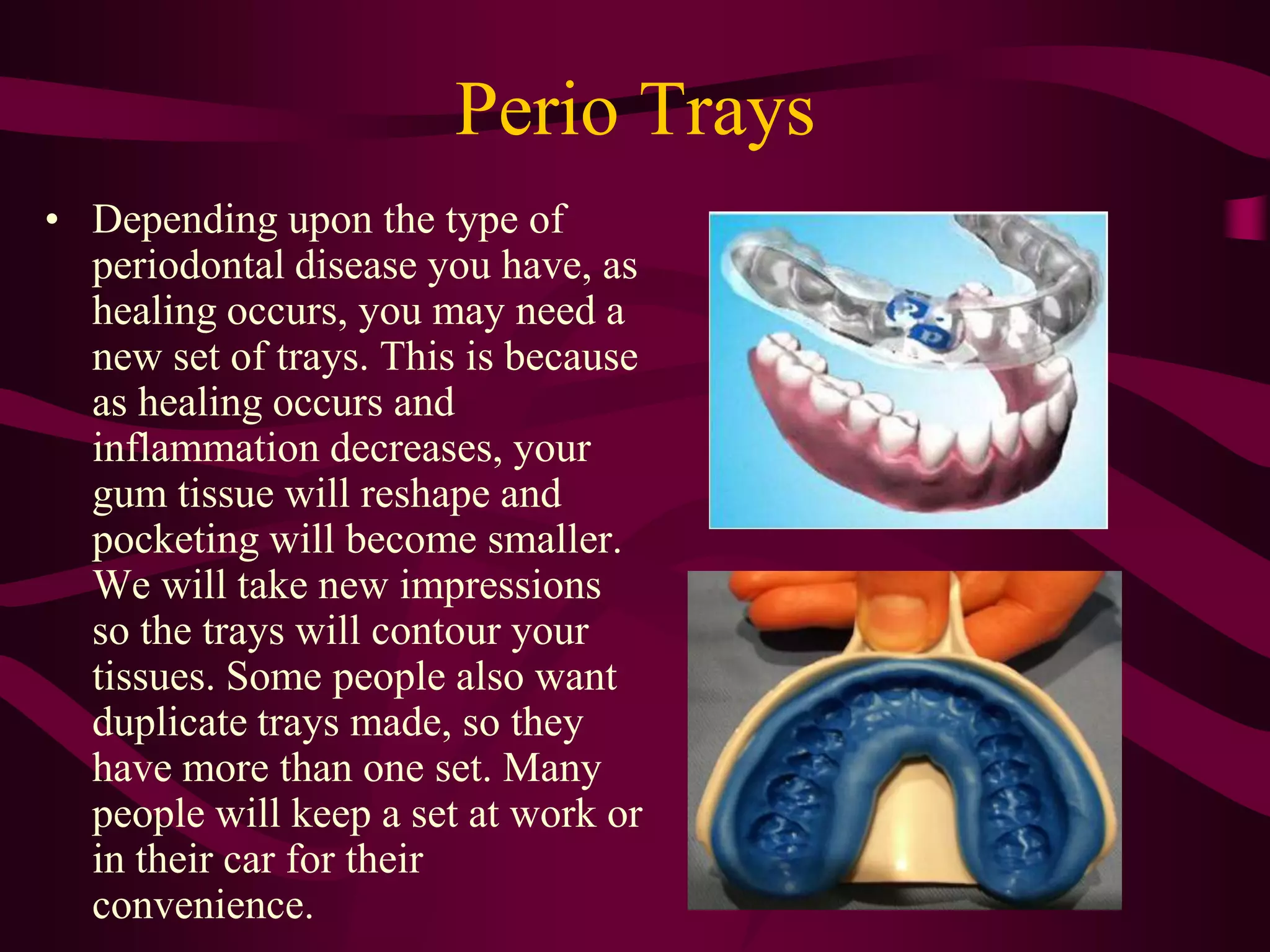 The Perio Protect Program | PPT