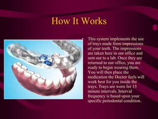 The Perio Protect Program | PPT