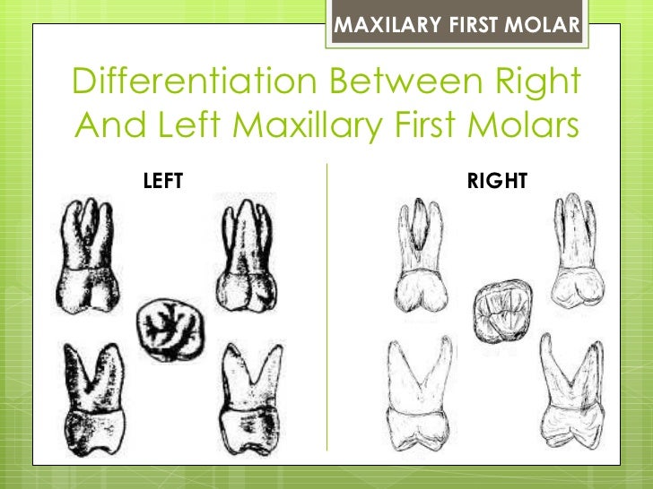The Permanent Maxillary First Molar