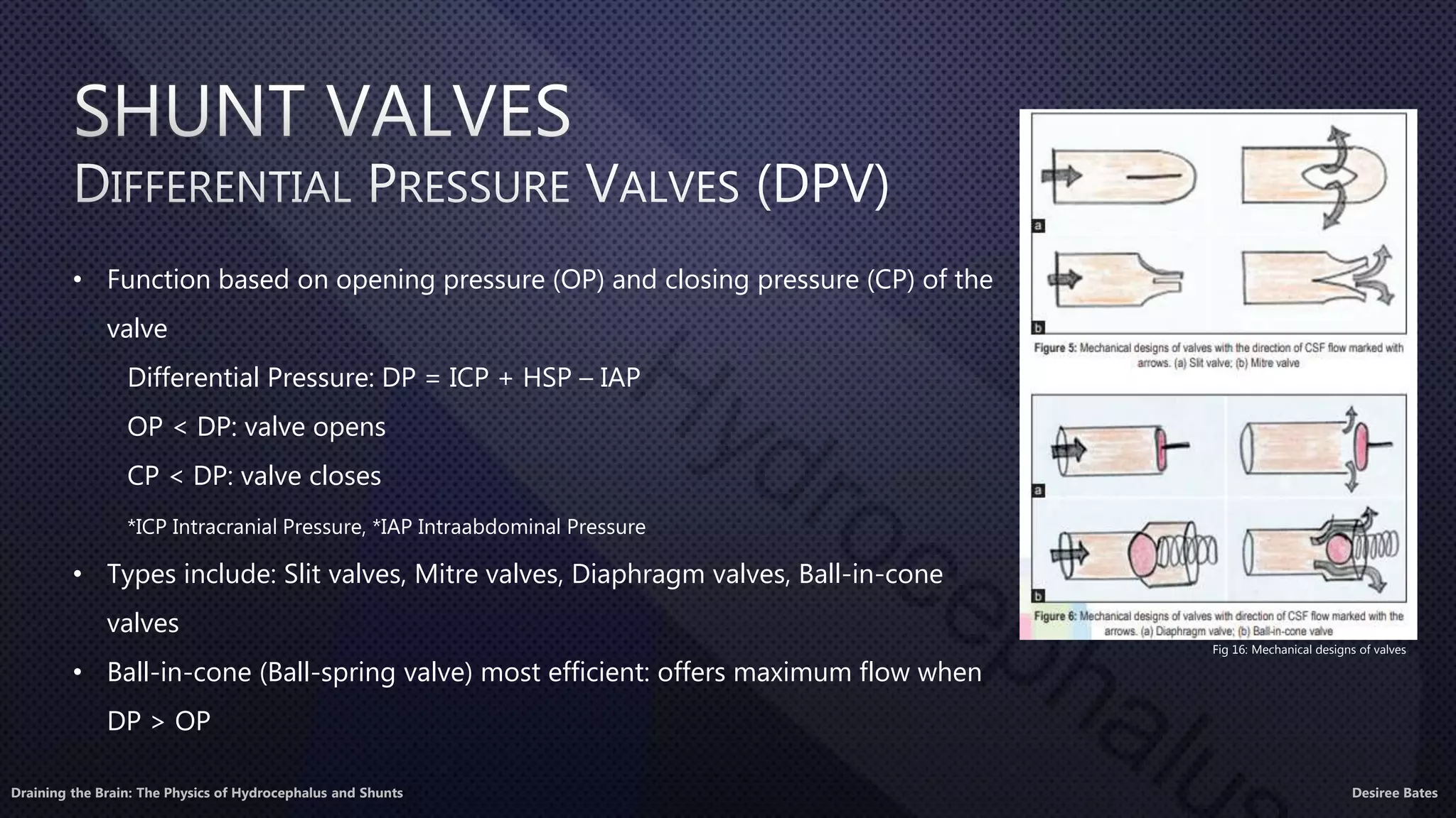 The Physics of Hydrocephalus and Shunts | PPTX