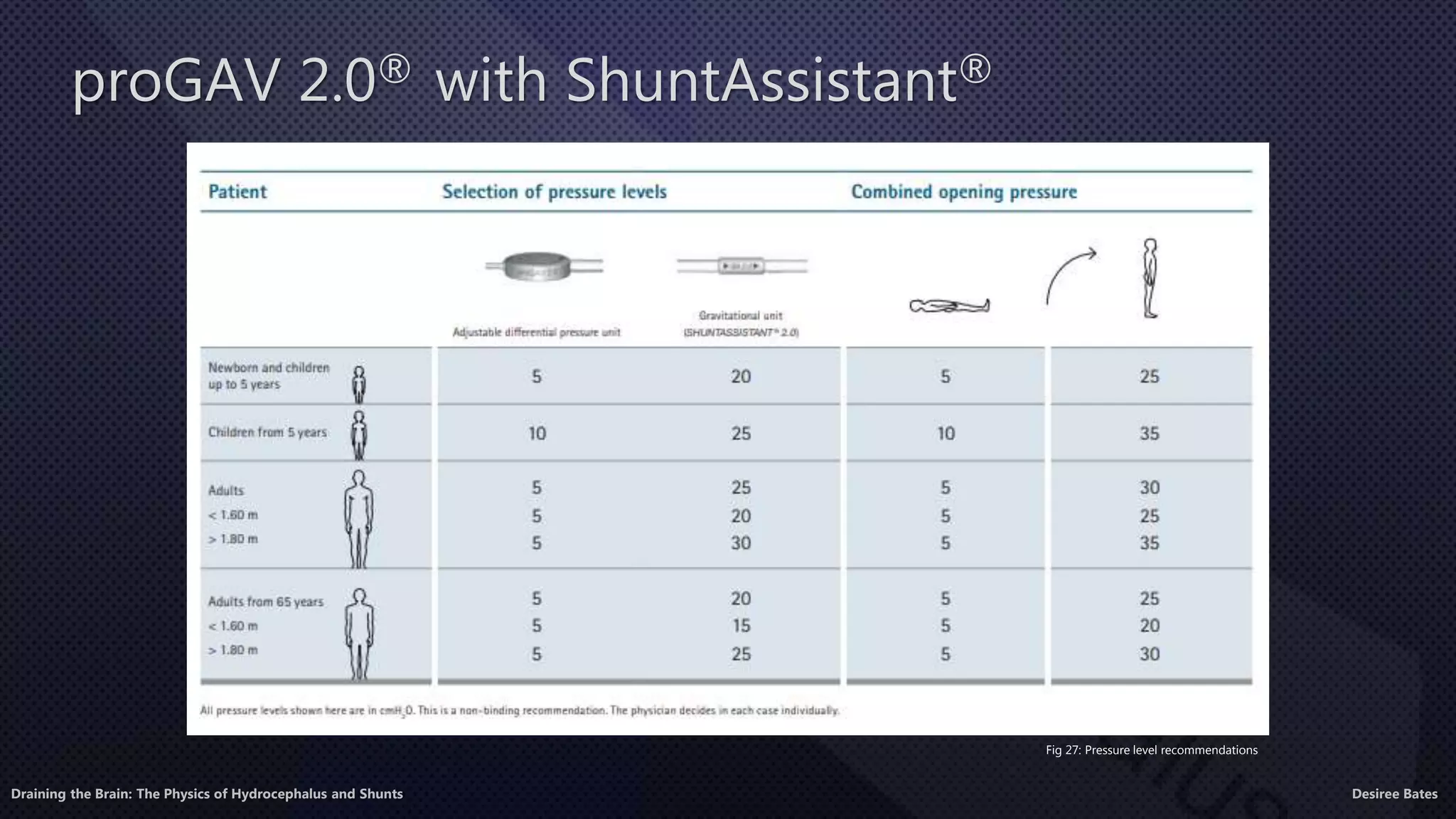 The Physics of Hydrocephalus and Shunts | PPTX