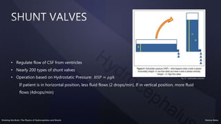 The Physics of Hydrocephalus and Shunts | PPTX | Brain and Nervous ...