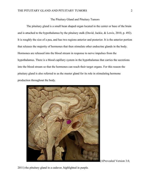 The Pituitary Gland And Pituitary Tumors | DOCX