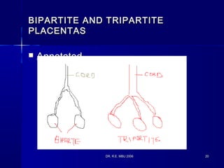 The placenta and its abnormalities | PPT