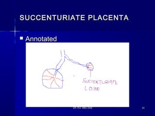 The placenta and its abnormalities | PPT