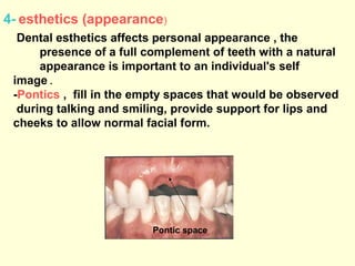 The pontics in_fixed_restorations | PPT