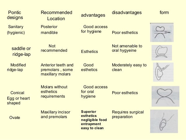 The pontics in_fixed_restorations